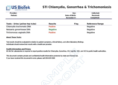 Chlamydia Gonorrhea & Trichomoniasis Panel