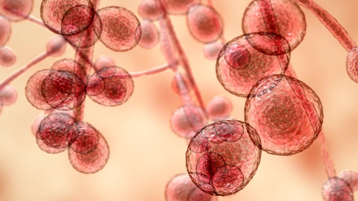 4 Things Clinicians Need to Know About Candida Immunoglobulin (Ig ...