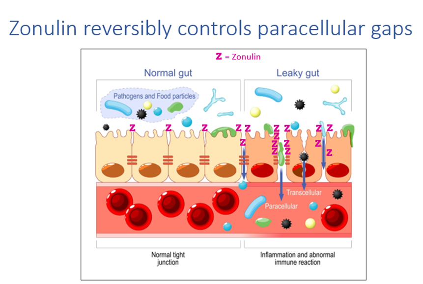 Fecal Zonulin - What does it tell us?